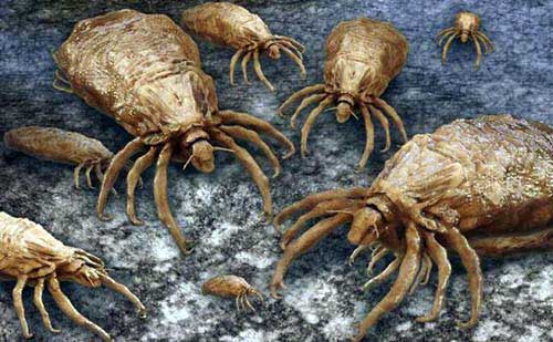 O que é Pediculose?