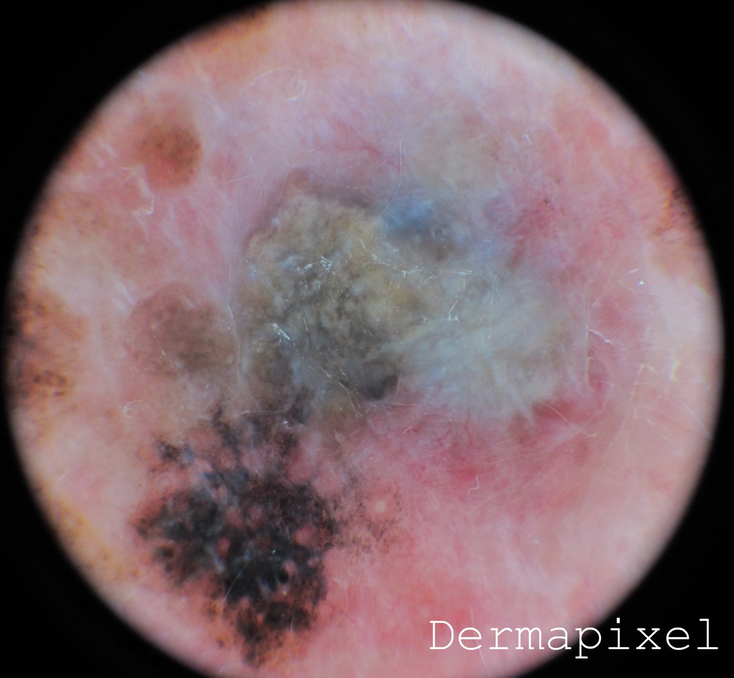 Dermapixel: junio 2012