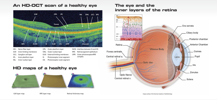 The Site for Healthcare Professionals: Optical Coherence Tomography (OCT)