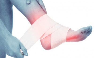 Acute Sports Injuries