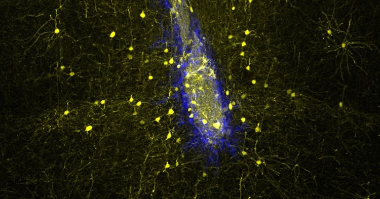 Our Parkinson's Place: New Neurons in the Brain