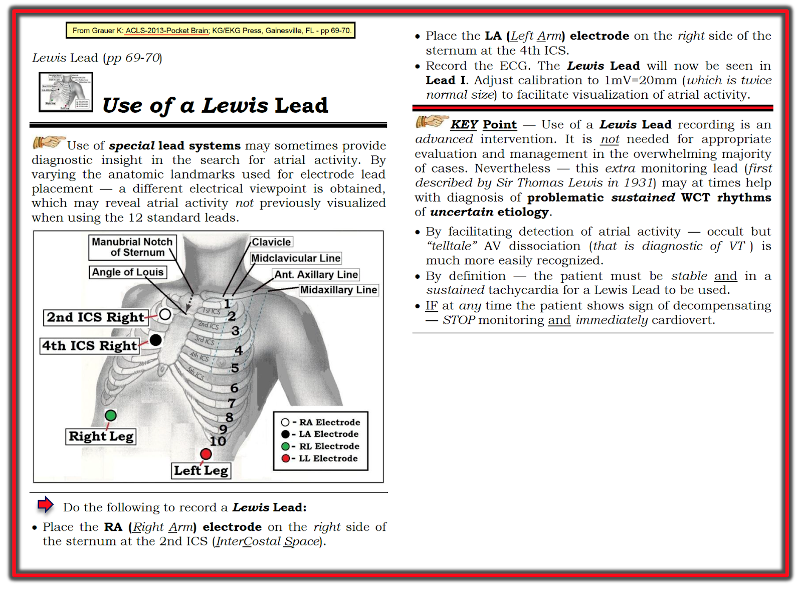 Dr. Smith's ECG Blog: What is this Regular SVT?