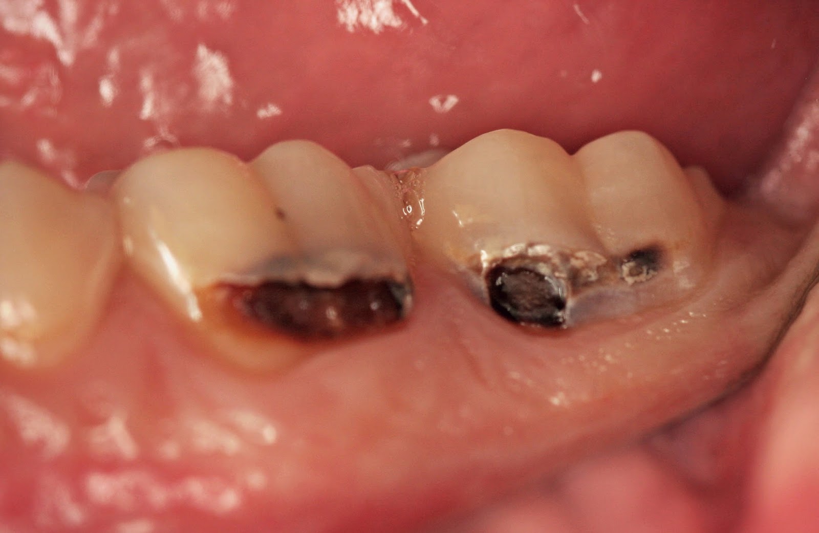 10 Things I See Most in Practice - TOOTH GERM
