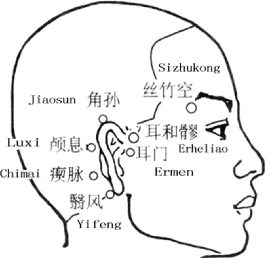 Meridian dan Titik Akupunktur : San Jiao (Triple Energizer/TE/SJ ...