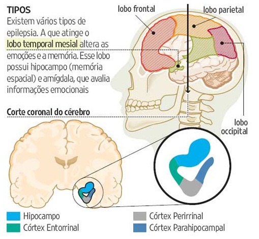Epilepsia do lobo temporal; Epilepsia Psicomotora Benigna da Infância