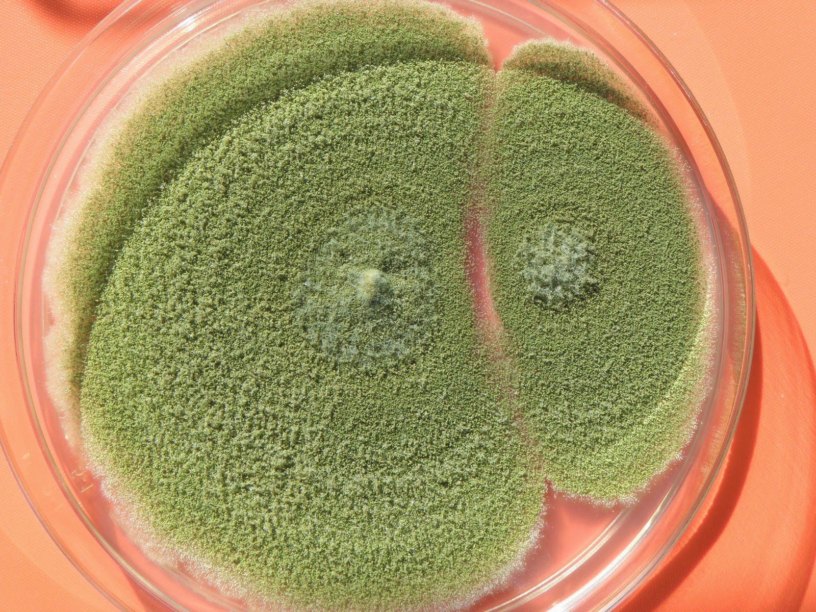 ATLAS MICOLOGIA: ASPERGILLUS FLAVUS