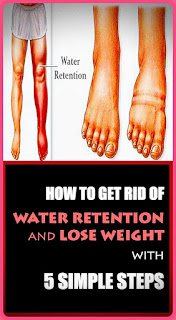How to Get Rid of Water Retention and Lose Weight With 5 Simple Steps ...