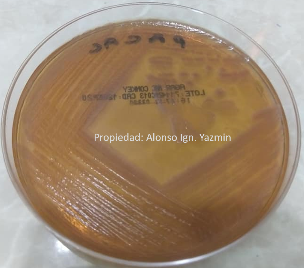 Bioquímica Diagnóstica BQD-YAI: Proteus mirabilis