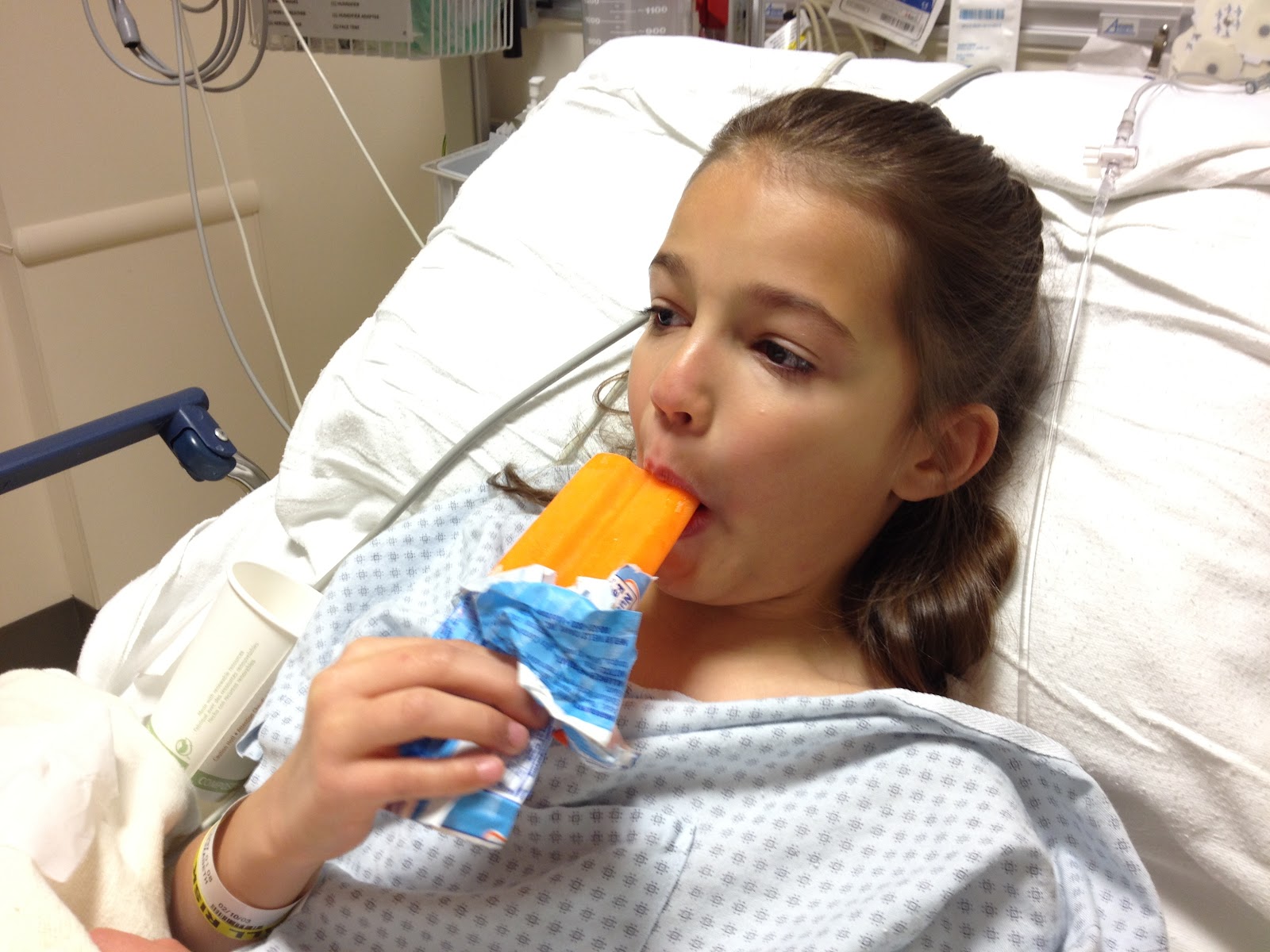 fibular hemimelia leg lengthening: Manipulation (Wiggle) Procedure