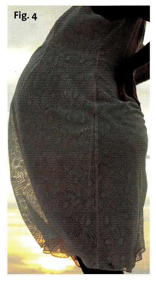 Centro de Reeducación Postural BIHOTZA: Dolor Lumbar durante el ...