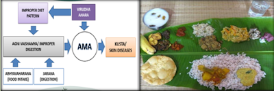 Why Is Pathya (Diet) Recommended In Ayurveda?
