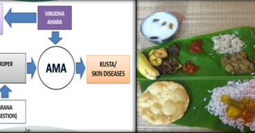 Why Is Pathya (Diet) Recommended In Ayurveda?