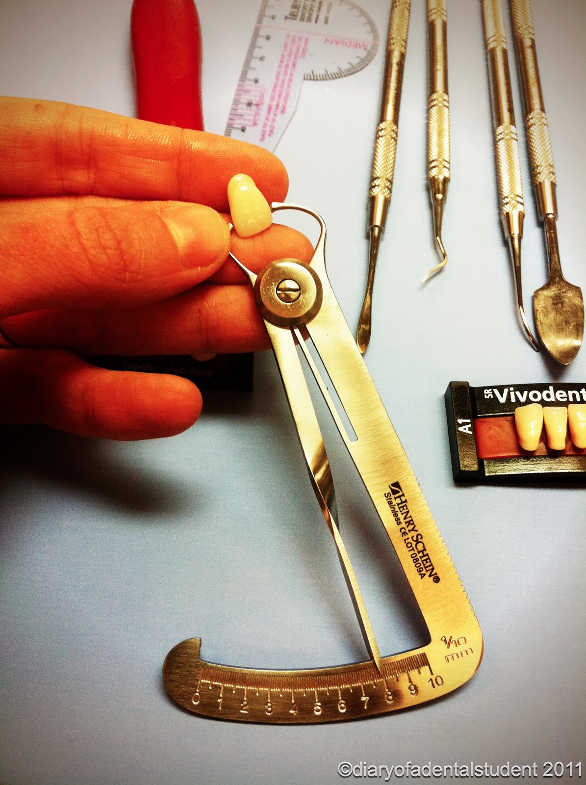 diary of a dental student: More Dentures!