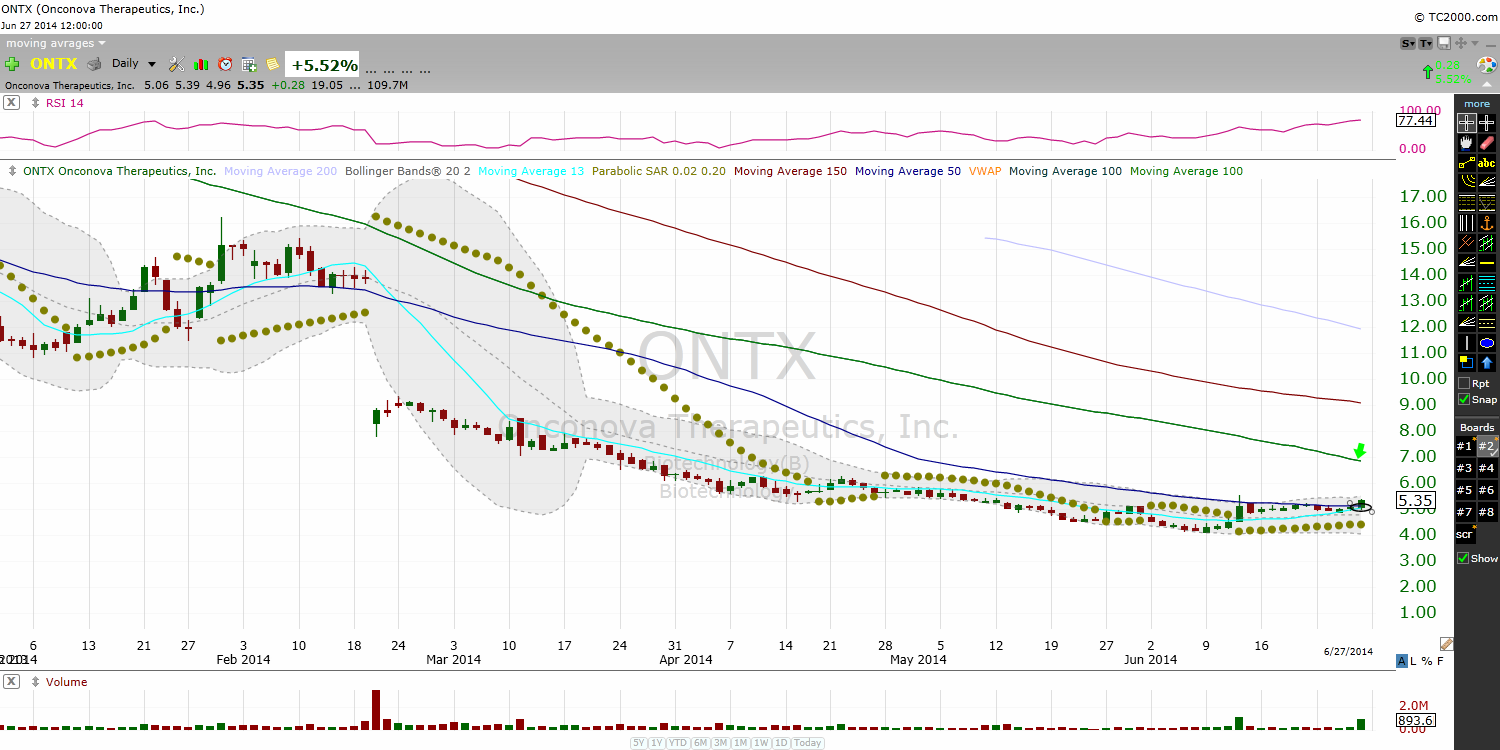 UPstocks - Trading the charts!