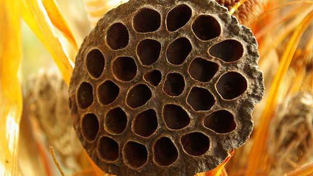 What is Trypophobia, Symptoms and Causes Treatment Of It - FOW 24 NEWS