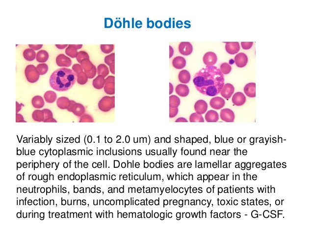 EXAMS AND ME : Dohle