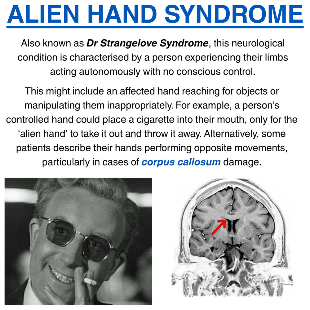 EXAMS AND ME : Alien Hand Syndrome