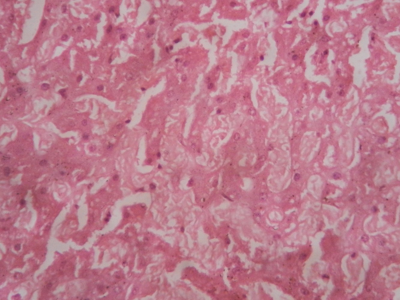 into the roots: Blood