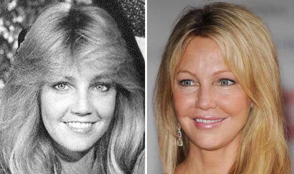 Heather Locklear Plastic Surgery