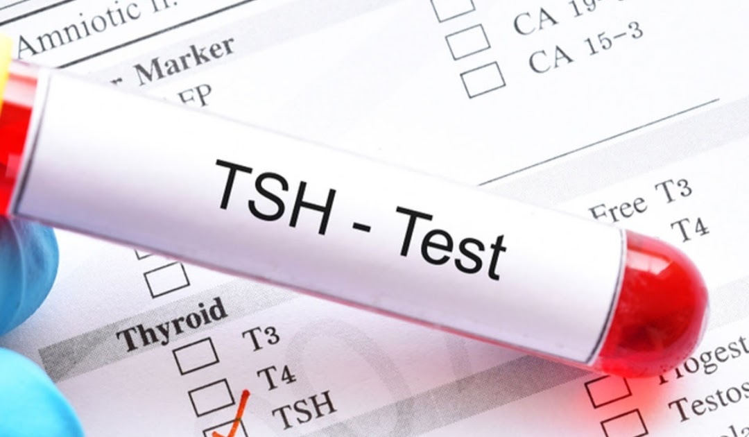 Thyroid-stimulating Hormone (TSH): Pengertian dan Apa yang Harus ...
