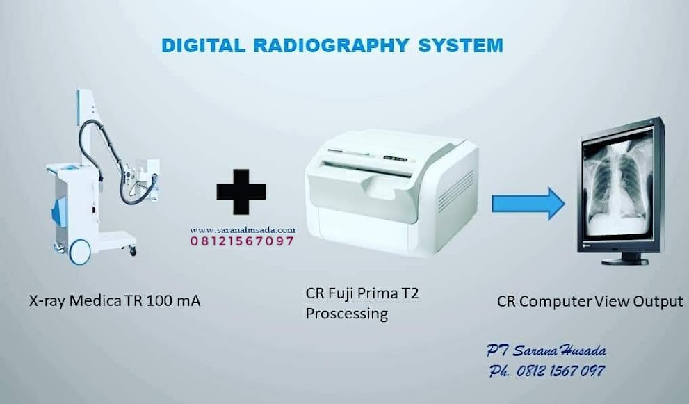 RADIOLOGY DIGITAL, Alat X RAY DILENGKAPI CR FUJI PRIMA T2 - ALAT X-RAY ...
