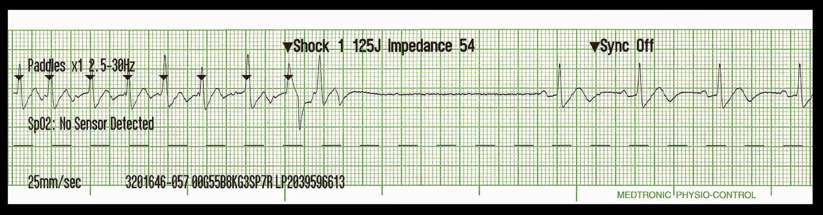 Practice EKG Strips 406