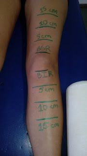 FisioEstudantes: Perimetria