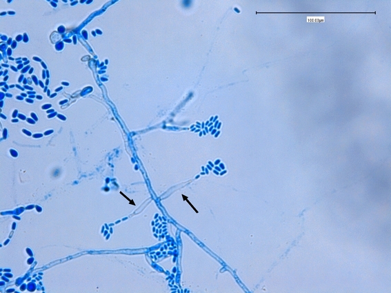 Fun With Microbiology (What's Buggin' You?): Arthrographis species