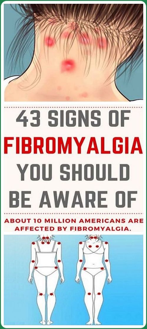 43 SIGNS OF FIBROMYALGIA YOU SHOULD BE AWARE OF | Heatlhy Nation 201