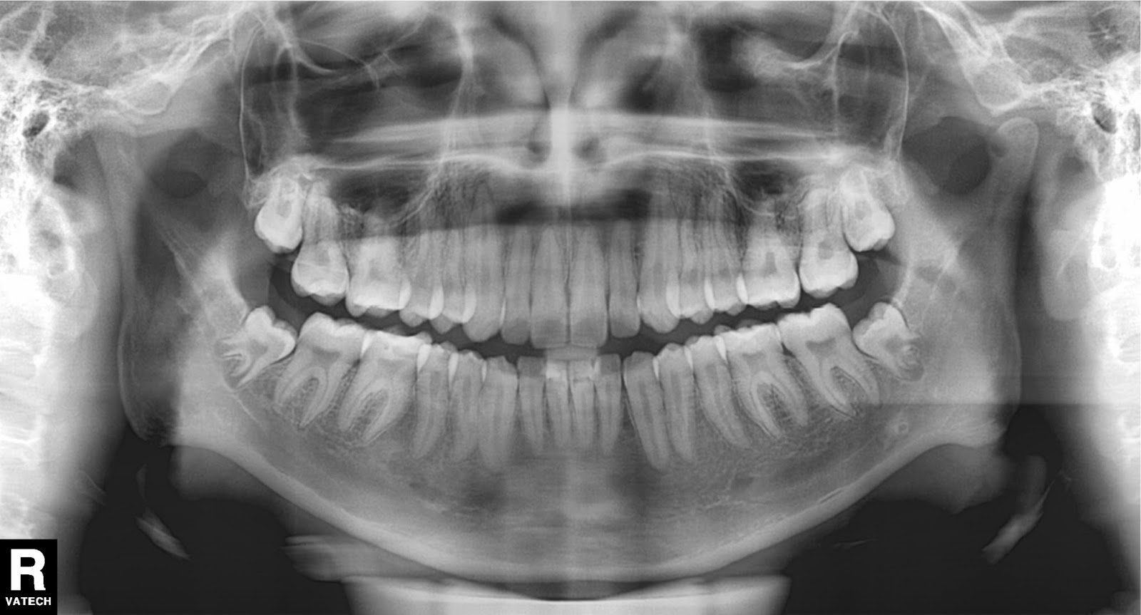 RADIOGRAFÍAS DENTALES