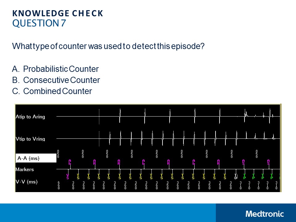 CVT Mohd Farid: Concept Of ICD Technology-Sensing & Detection-Medtronic ...