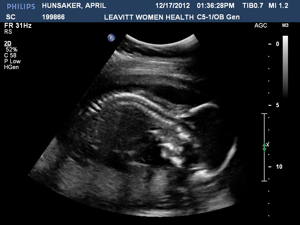 Hunsaker Zoooooo: 21 Week Ultrasound