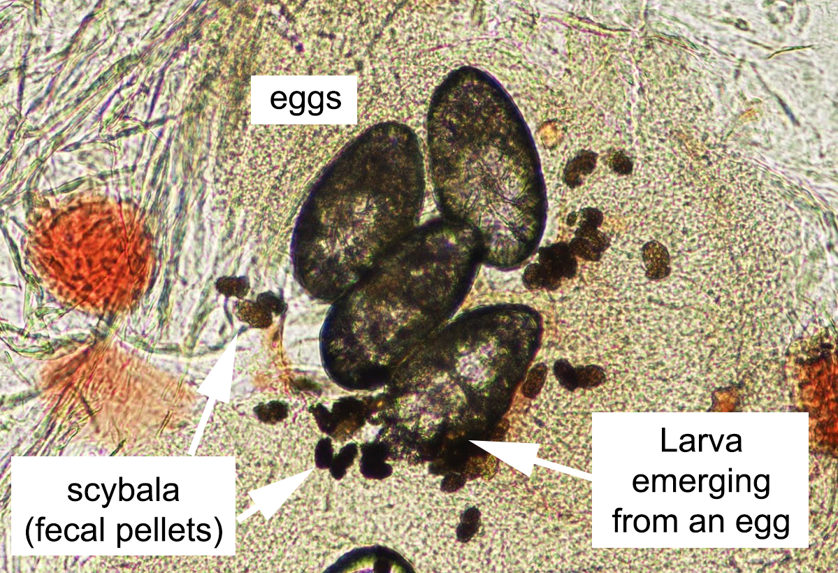 Creepy Dreadful Wonderful Parasites: Answer to Case 569