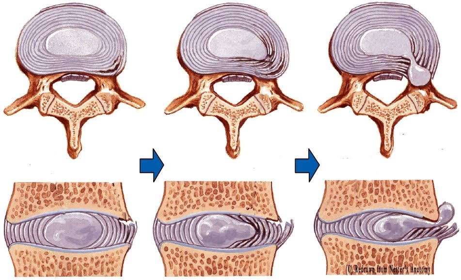 Clinica Petrillo - Otorrinolaringologia e Fisioterapia
