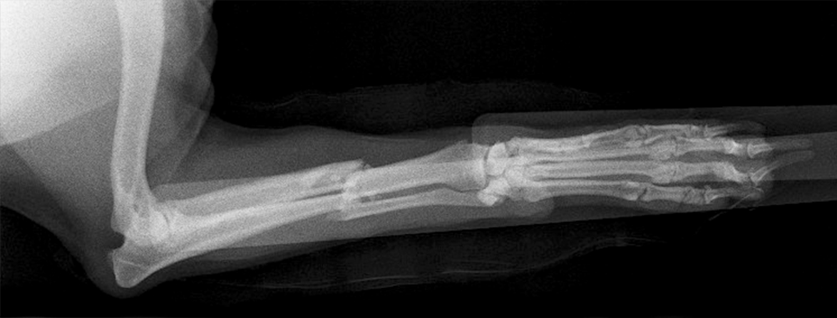 ARTROVET: Fractura de cúbito y radio