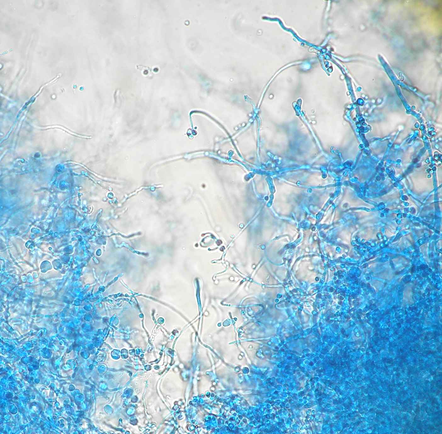 ATLAS MICOLOGIA: TRICHOPHYTON INTERDIGITALE