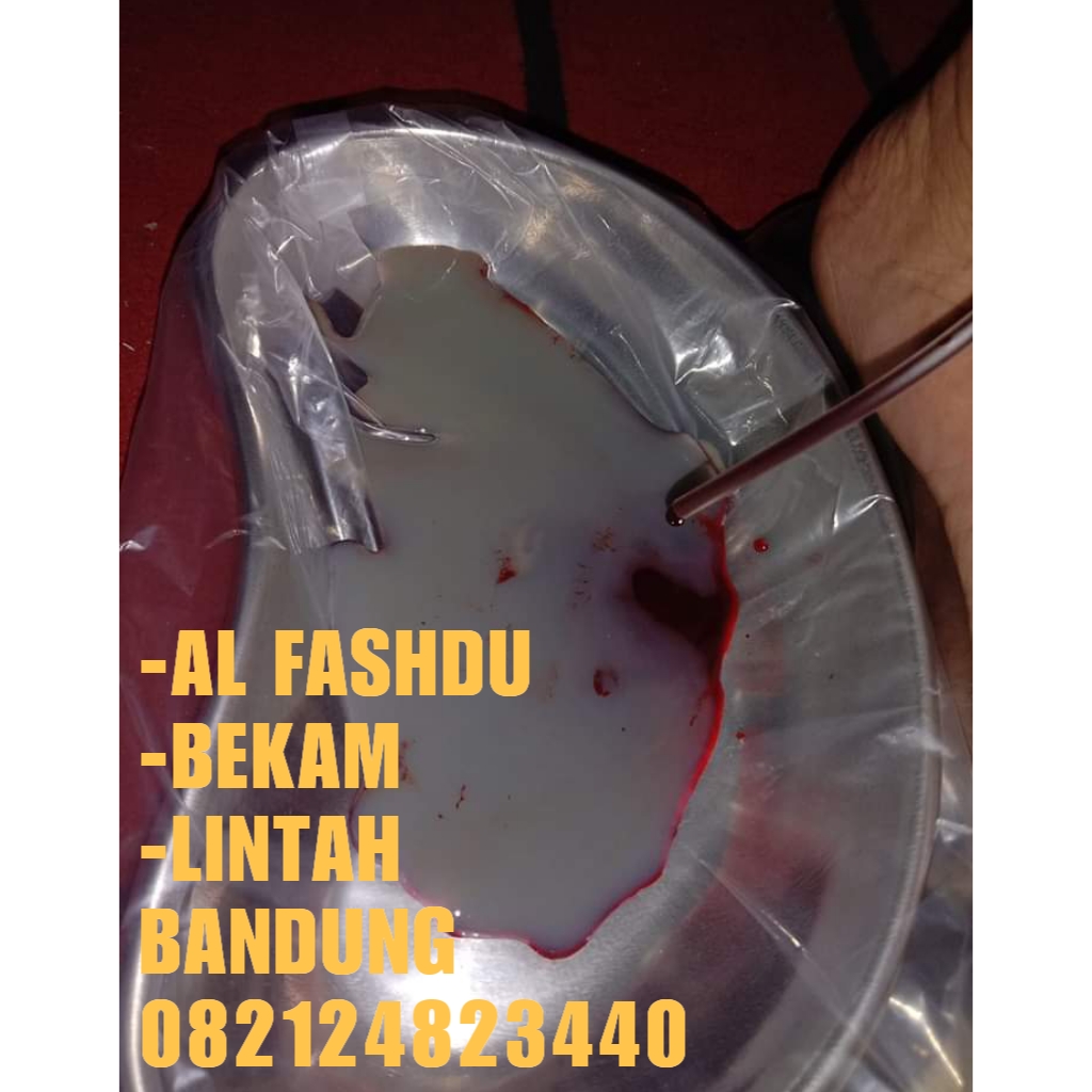 Pashod bandung 082124823440