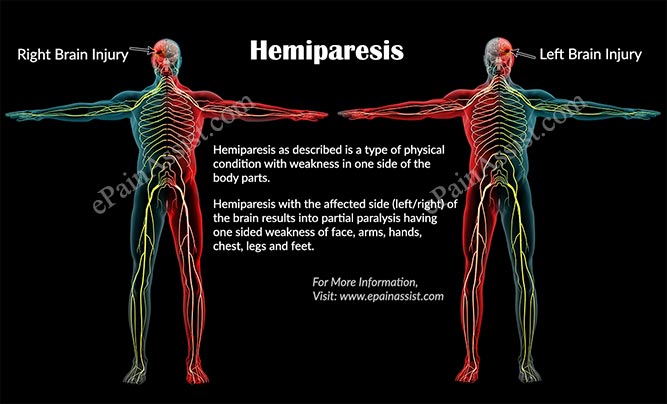 Physical Therapist, Health & Wellness: