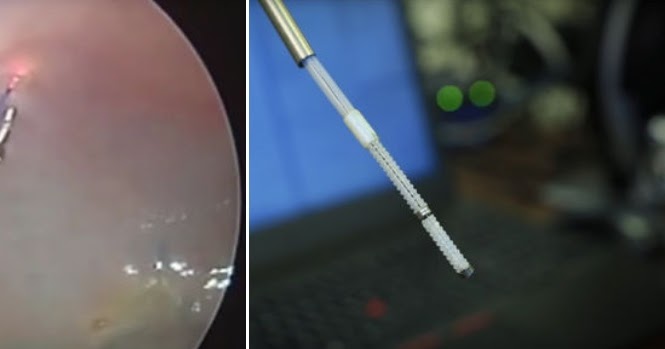 Inside Vanderbilt's surgical robotics labs