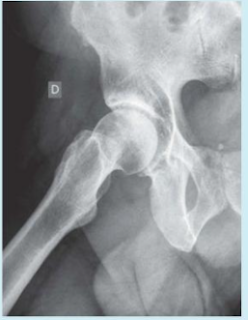 Estudios radiográficos que comprenden miembros inferiores y superiores ...