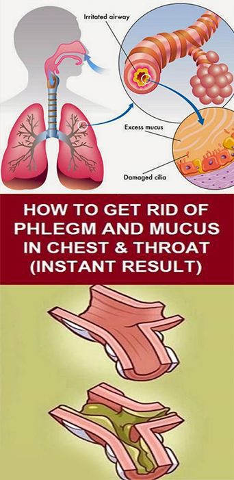 How to Get Rid of Phlegm and Mucus in Chest & Throat (Instant Result ...