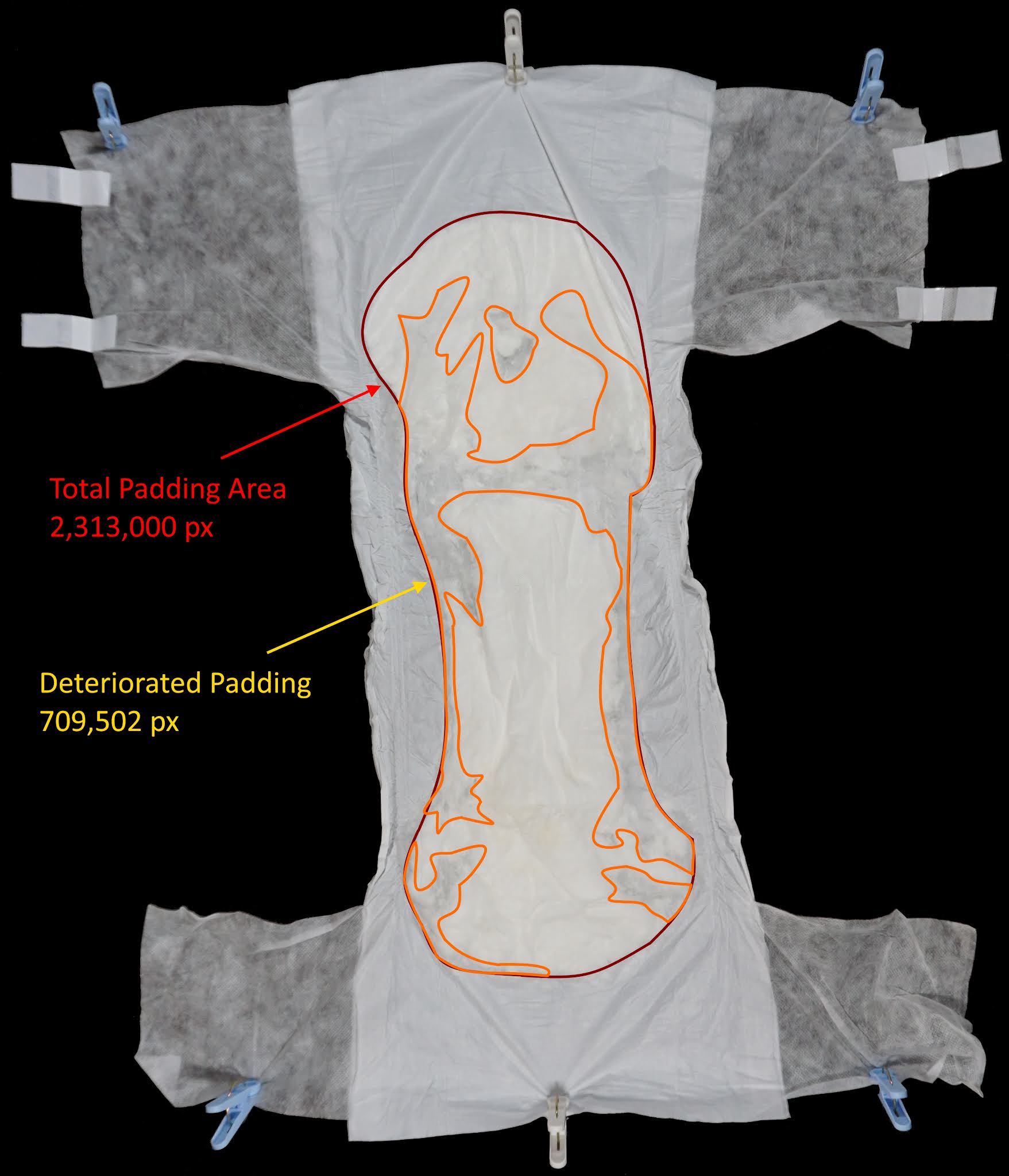Diaper Metrics: Healthy Spirit Adult Diaper Review