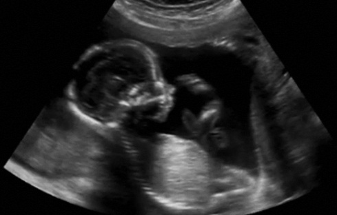 Kapan Waktu Yang Tepat USG 4D? Ini Jawabannya - BANGUN KELIR