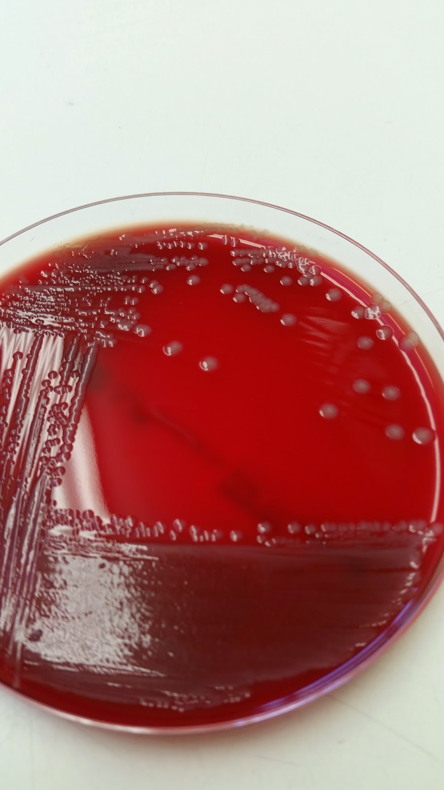 Microbiologylog: Salmonella spp. from Blood culture