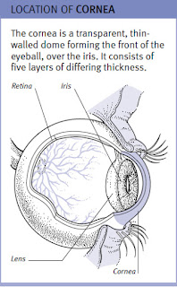 Cornea ~ Nursing