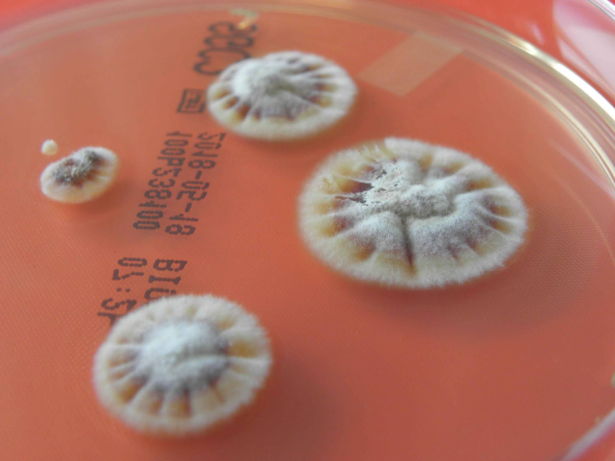 ATLAS MICOLOGIA: TRICHOPHYTON RUBRUM - COLÓNIA COM 13 DIAS DE INCUBAÇAÕ