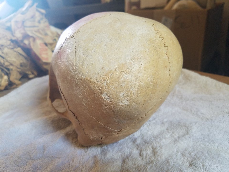 "Missy Skull" Unexplained Skull Study