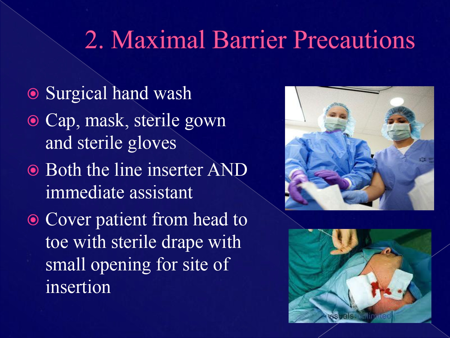 Importance of Infection Prevention from CLABSI and Use of Care Bundle ...