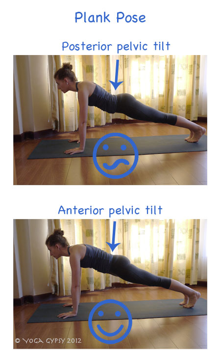 Warning for people with APT who are doing planks, don't straighten ...