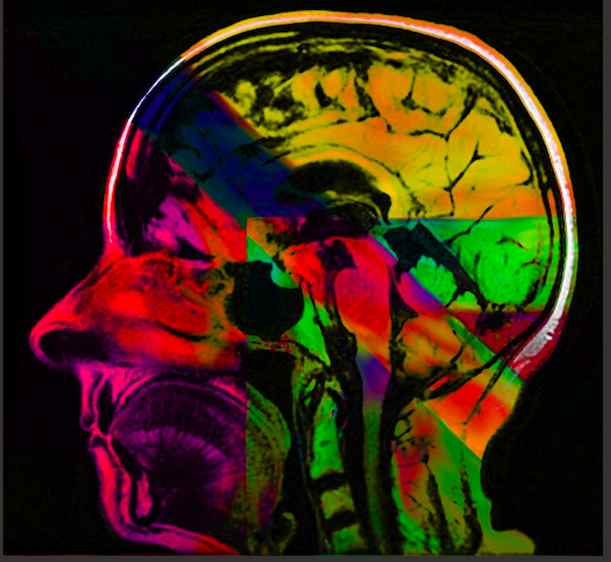 Teaching High School Psychology: Images from The Beautiful Brain